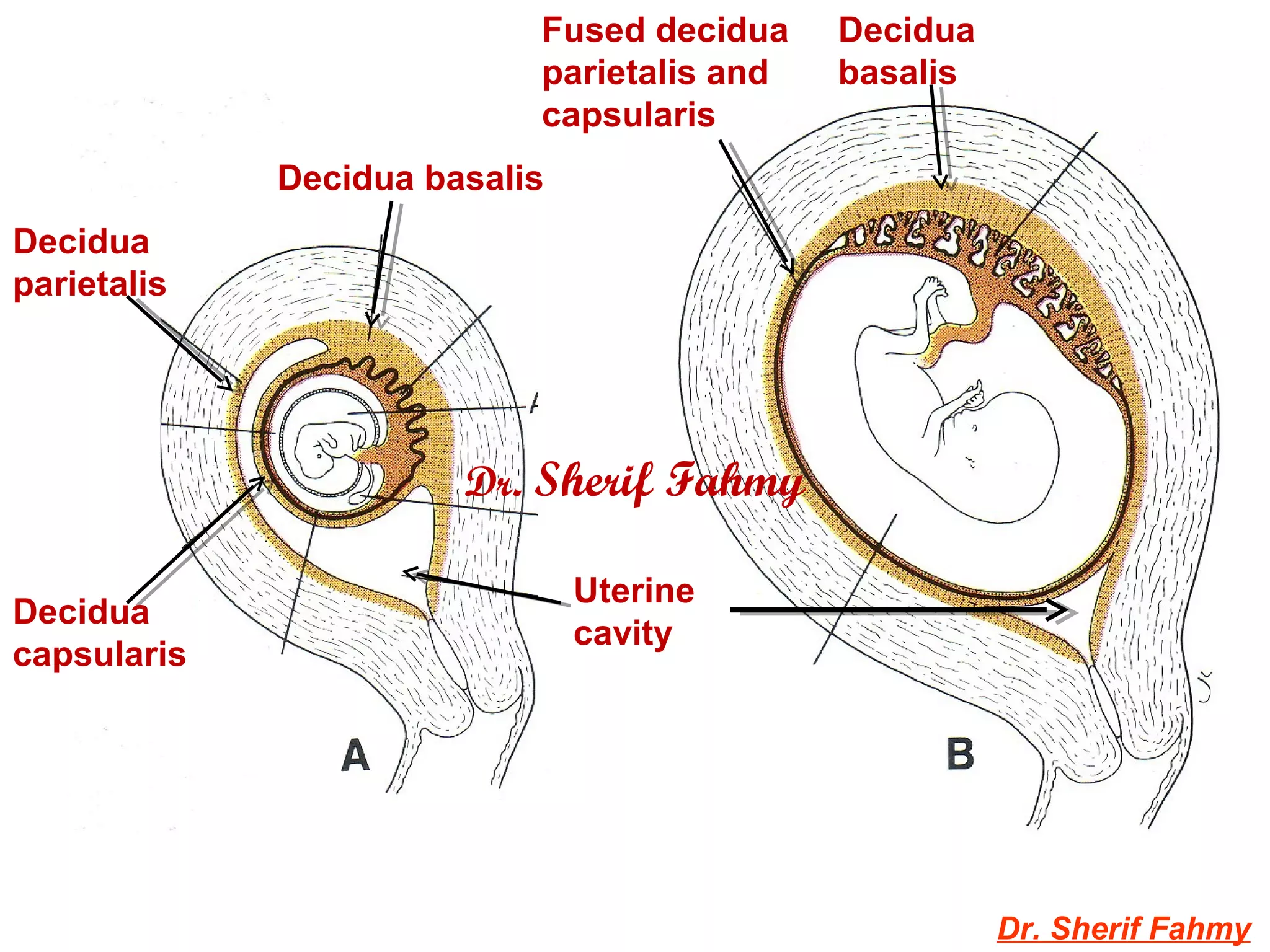 Decidua & Chorionic Velli (General Embryology) | PPS