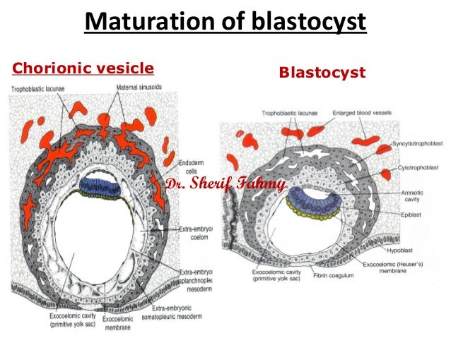 Decidua & Chorionic Velli (General Embryology)