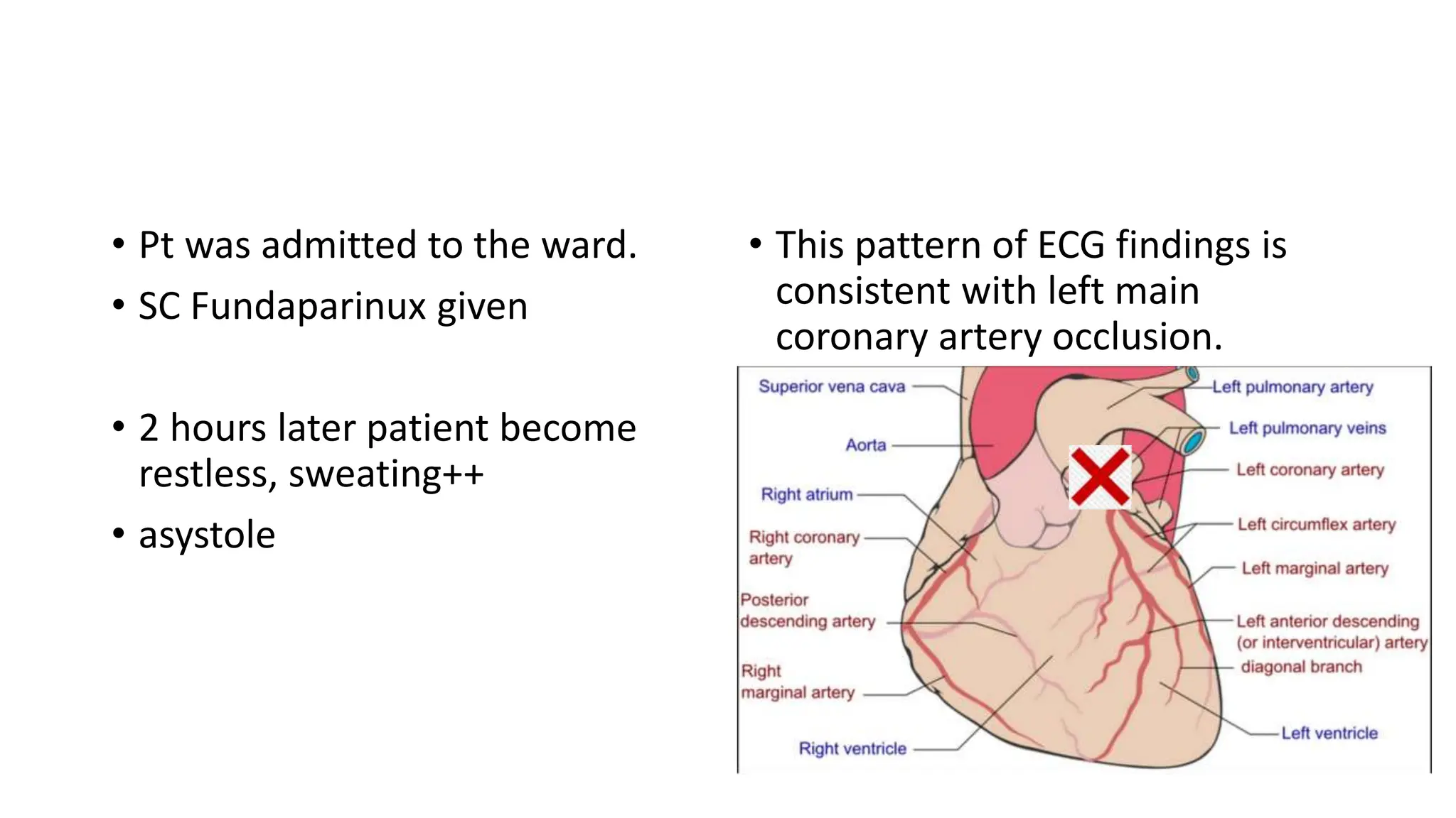 DECIPHERING COMMON ECG FINDINGS IN ED.pptx