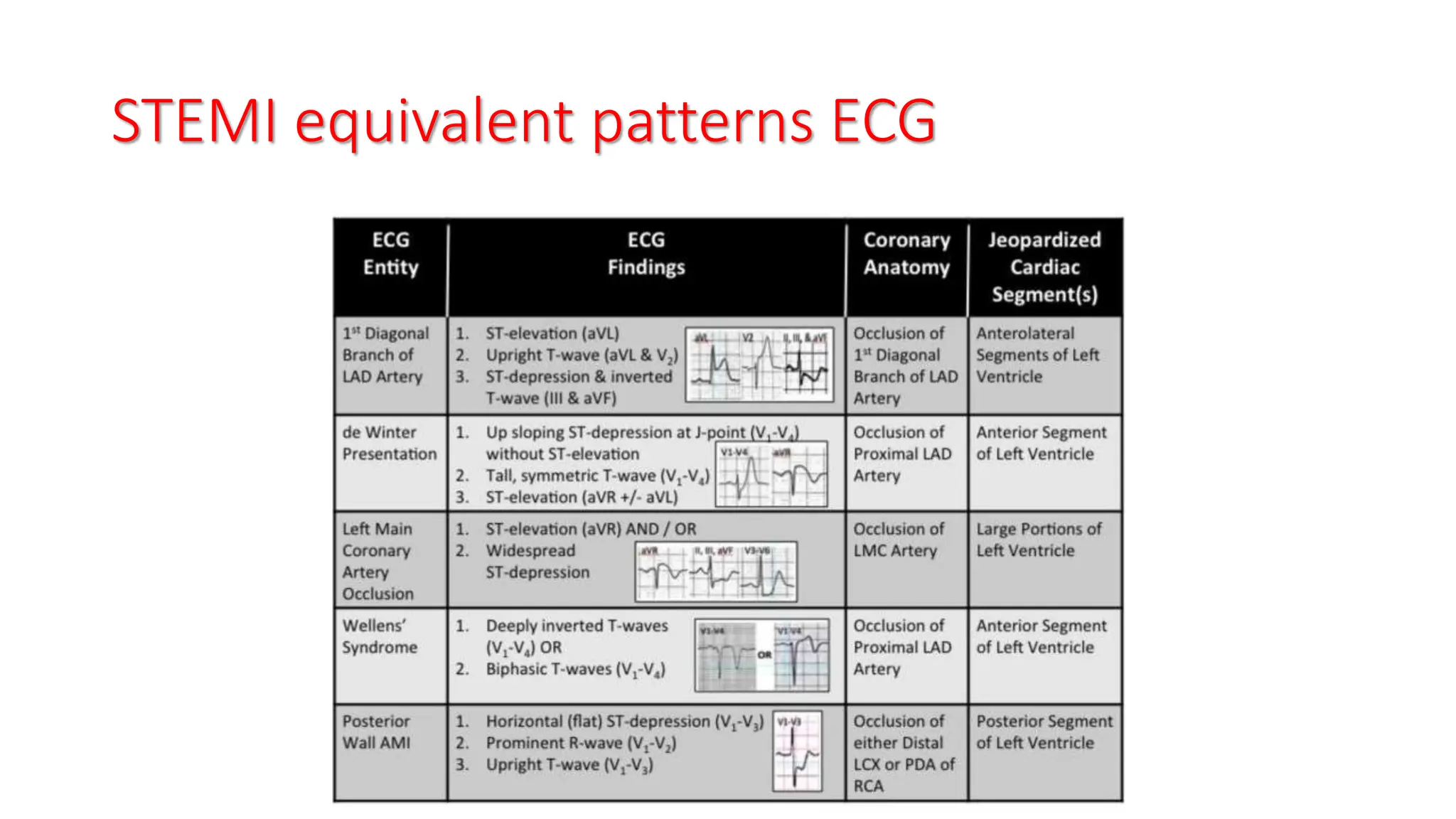 DECIPHERING COMMON ECG FINDINGS IN ED.pptx