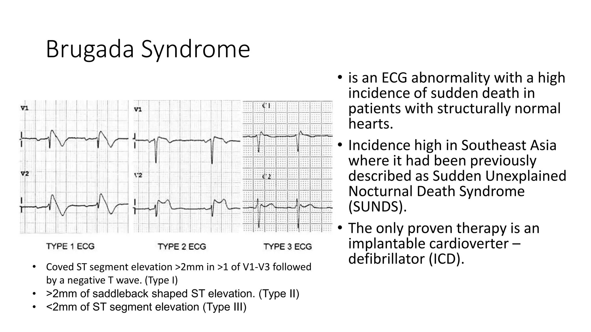 DECIPHERING COMMON ECG FINDINGS IN ED.pptx
