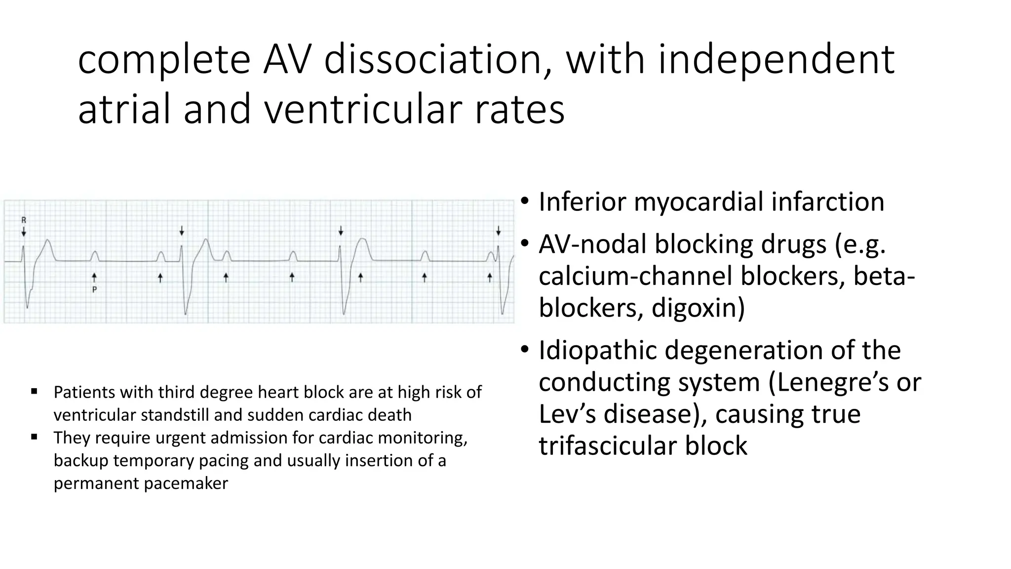 DECIPHERING COMMON ECG FINDINGS IN ED.pptx