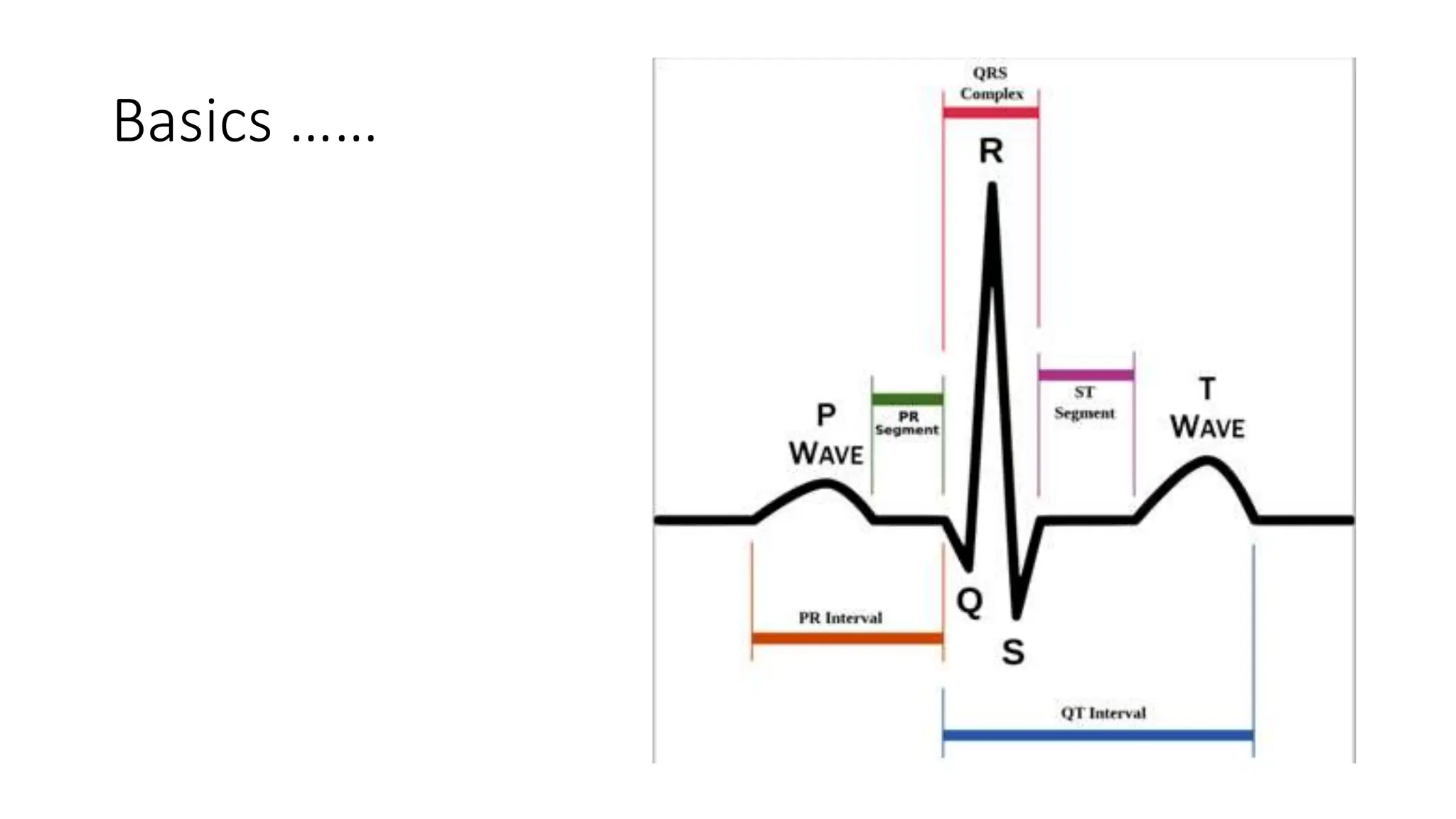 DECIPHERING COMMON ECG FINDINGS IN ED.pptx