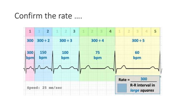 DECIPHERING COMMON ECG FINDINGS IN ED.pptx