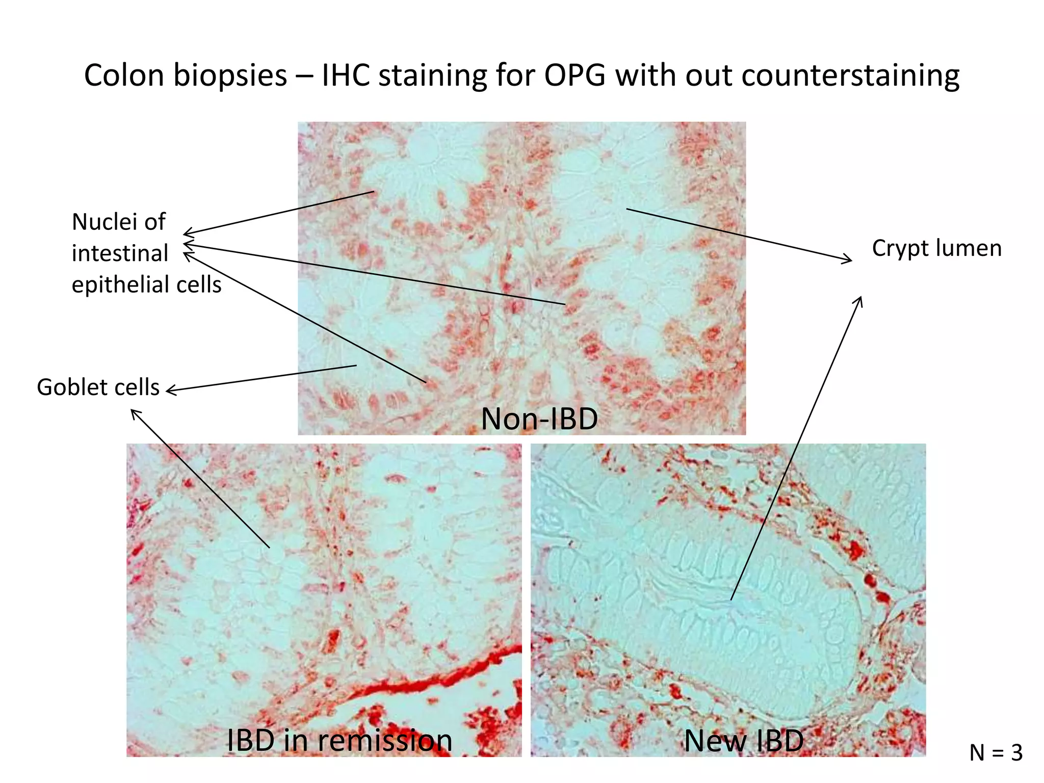 Deciphering the role of osteoprotegerin in inflammatory bowel diseases ...