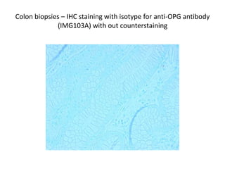 Deciphering the role of osteoprotegerin in inflammatory bowel diseases ...