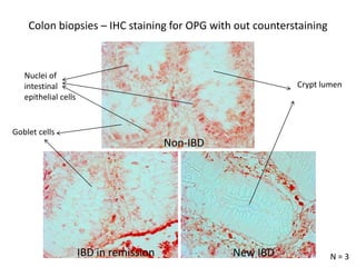 Deciphering the role of osteoprotegerin in inflammatory bowel diseases ...