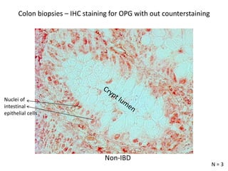 Deciphering the role of osteoprotegerin in inflammatory bowel diseases ...