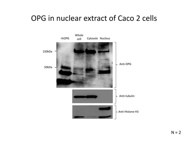 Deciphering the role of osteoprotegerin in inflammatory bowel diseases ...