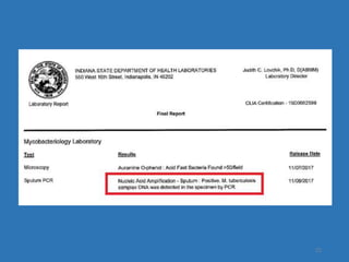Deciphering Tuberculosis Lab Reports.ppt