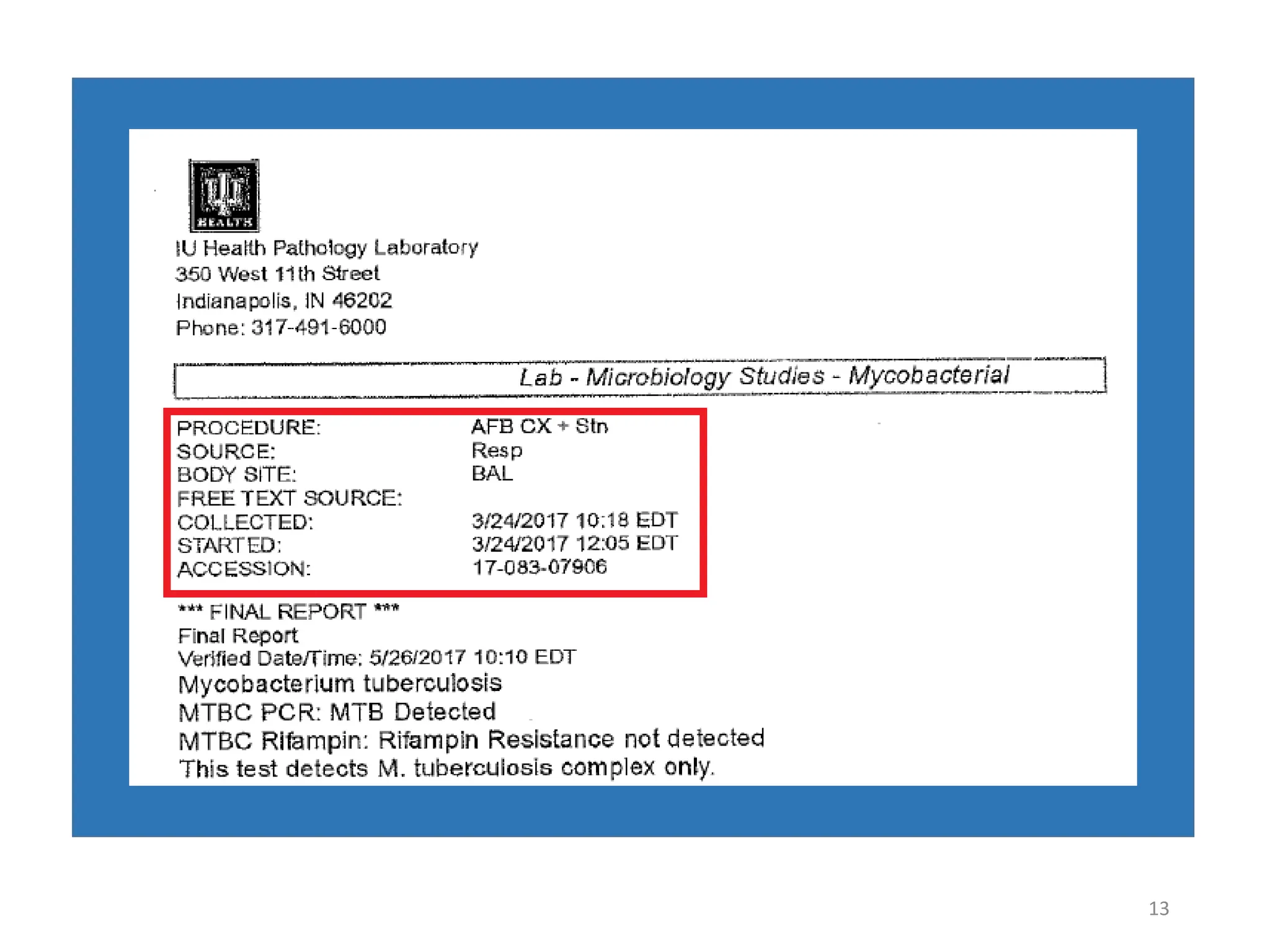 Deciphering Tuberculosis Lab Reports.ppt