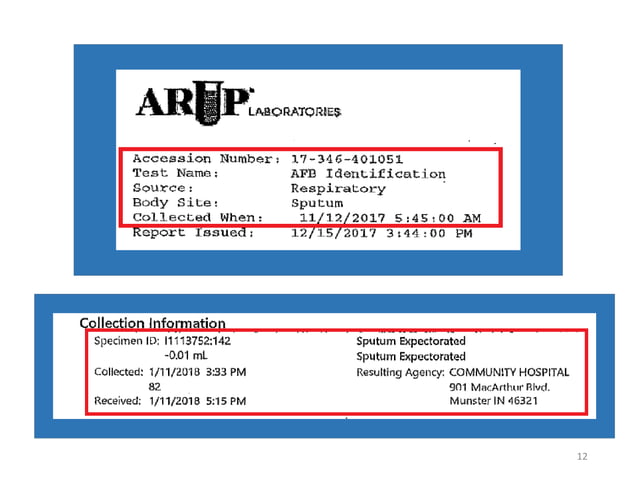 Deciphering Tuberculosis Lab Reports.ppt