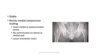 Decision making in fractures around hip icl 2019 chit | PPTX
