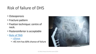 Decision making in fractures around hip icl 2019 chit | PPTX