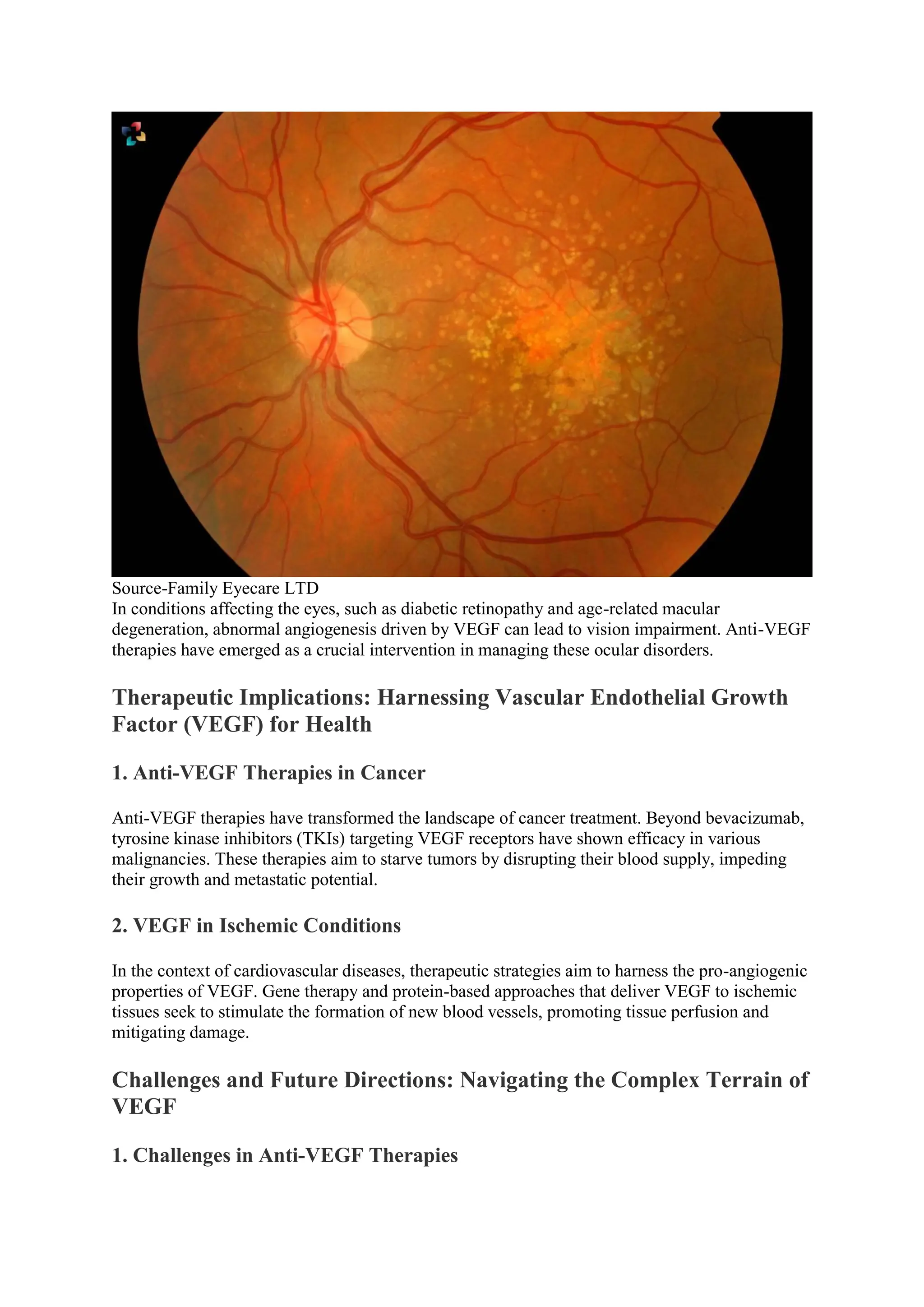 Vascular Endothelial Growth Factor (VEGF): Role, Family, Disease ...