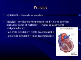 Decompensatio cordis extra | PPT