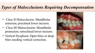 decompensation of skeletal malocclusion.pptx