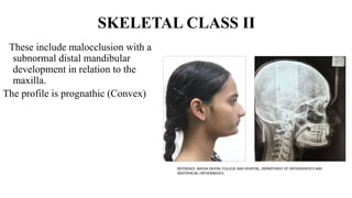 decompensation of skeletal malocclusion.pptx