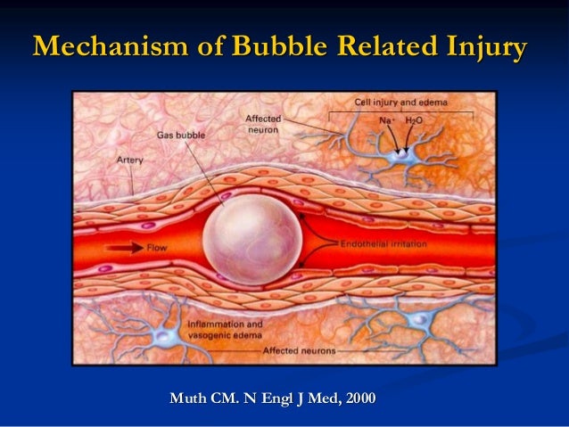 Decompression illness