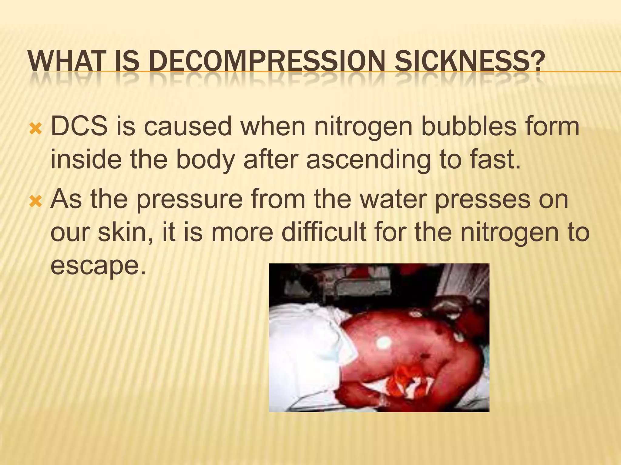 Decompression sicknessppt | PPTX