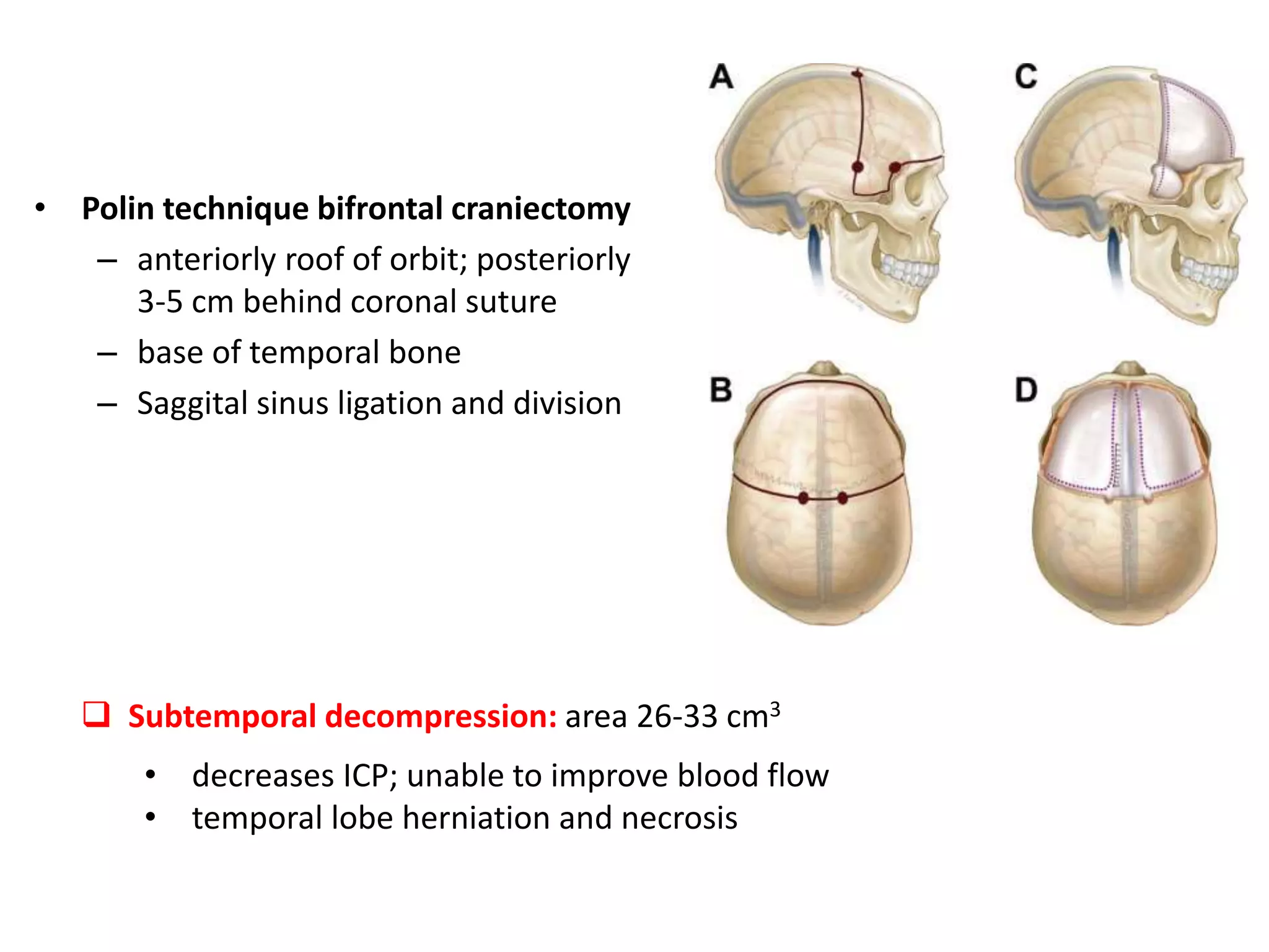 Decompressive Craniectomy.pptx