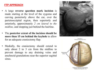 Decompressive Craniectomy.pptx