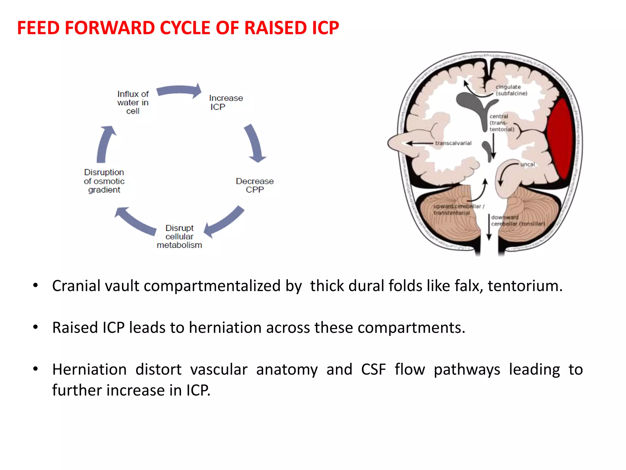 Decompressive Craniectomy.pptx