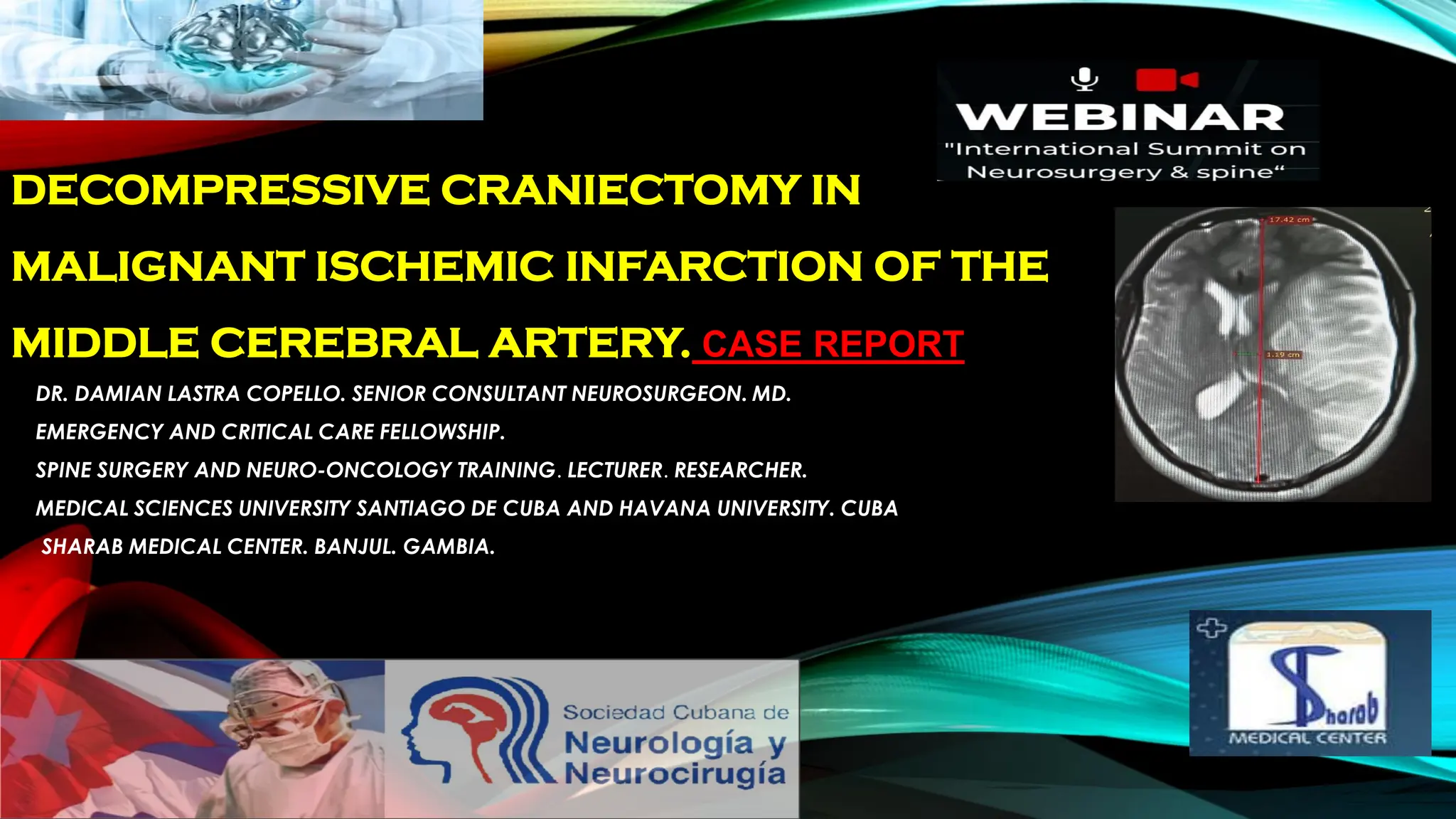 DECOMPRESSIVE CRANIECTOMY IN MALIGNANT ISCHEMIC INFARCTION OF THE ...