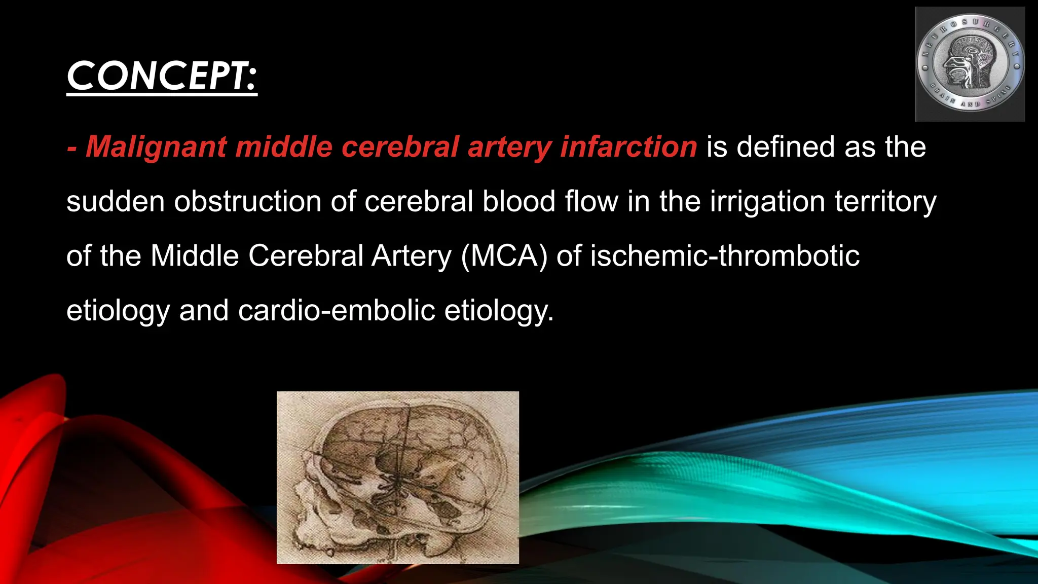 DECOMPRESSIVE CRANIECTOMY IN MALIGNANT ISCHEMIC INFARCTION OF THE ...