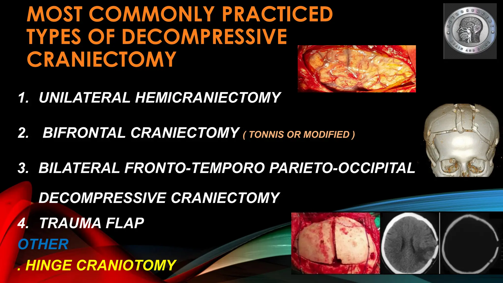 DECOMPRESSIVE CRANIECTOMY IN MALIGNANT ISCHEMIC INFARCTION OF THE ...