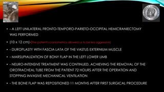 DECOMPRESSIVE CRANIECTOMY IN MALIGNANT ISCHEMIC INFARCTION OF THE ...