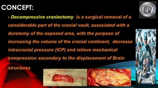 DECOMPRESSIVE CRANIECTOMY IN MALIGNANT ISCHEMIC INFARCTION OF THE ...