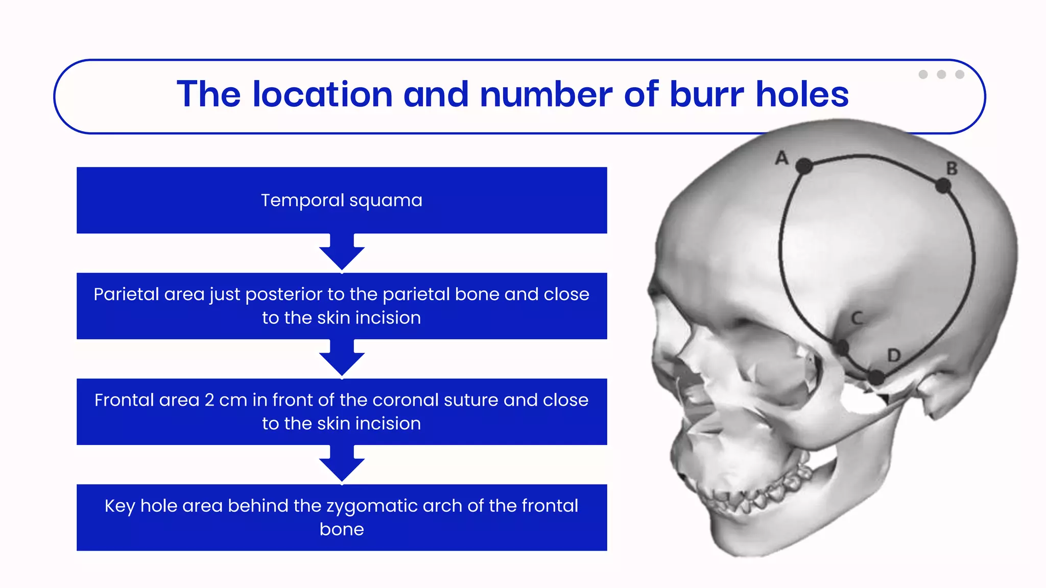 Decompressive Craniectomy in Traumatic Brain Injury A Review Article.pptx
