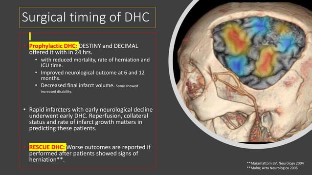 Decompressive hemicraniectomy for Large Hemispheric infarction | PPTX ...