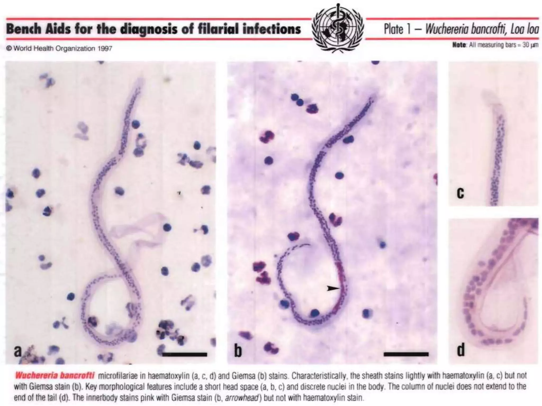 Dec provocation test (lymphatic filiarisis) | PPTX