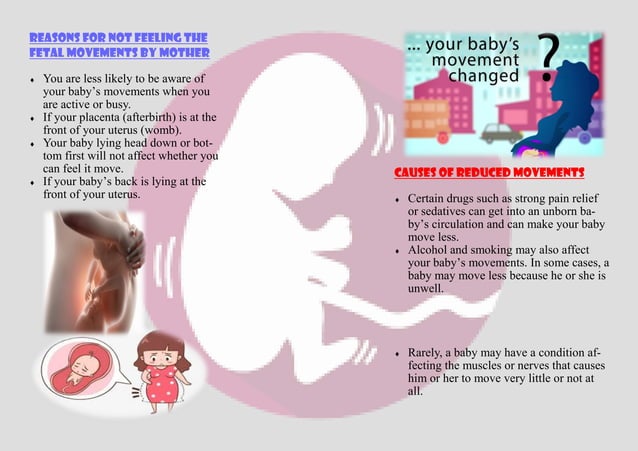 Decreased fetal movement | PPT