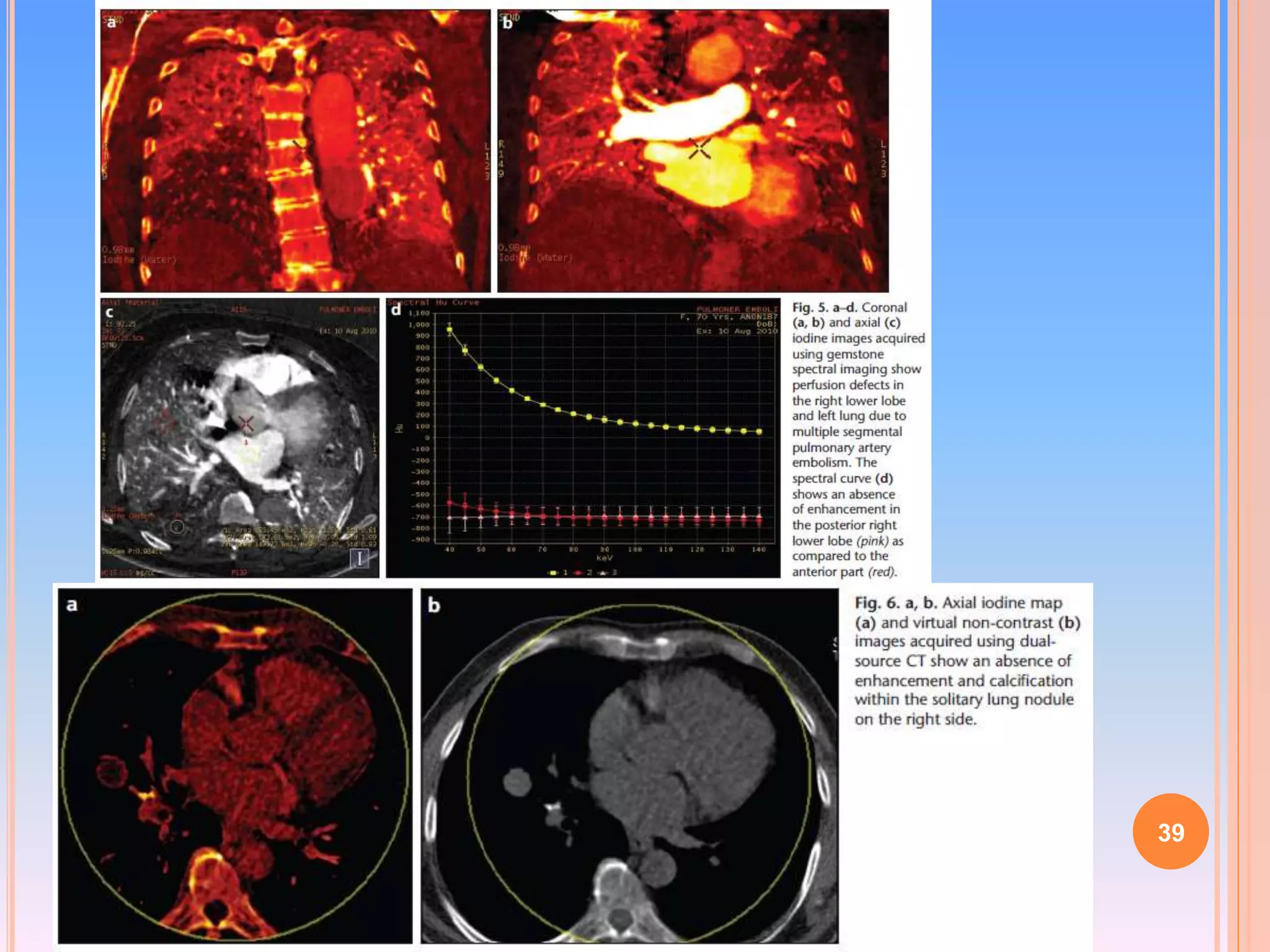Dual Energy CT | PPTX