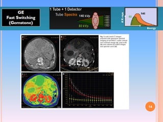 Dual Energy CT | PPTX