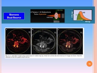 Dual Energy CT | PPTX