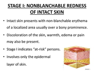 Decubetic ulcer (bed sores) | PPTX | Skin and Dermatology | Diseases ...