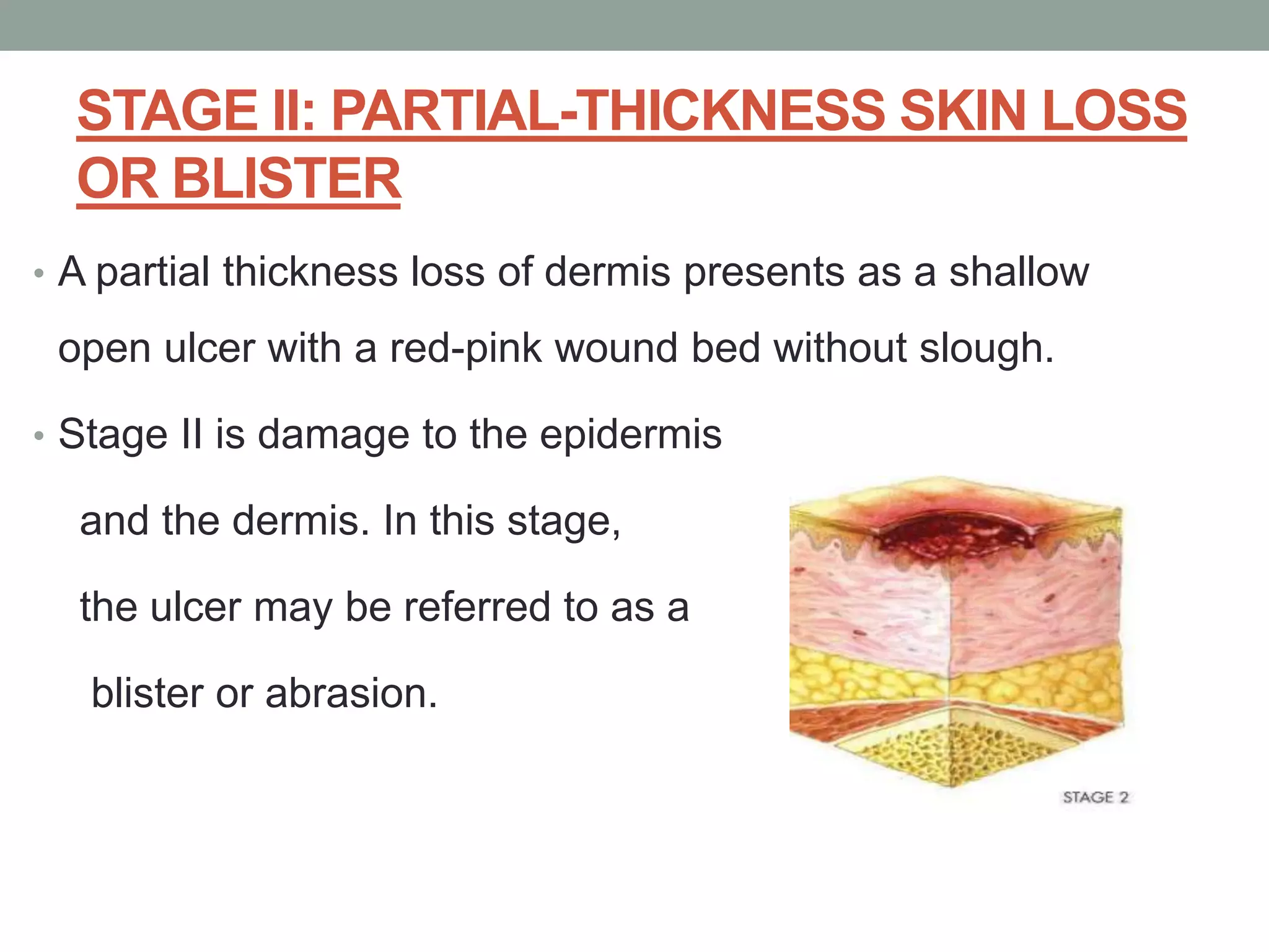 DECUBETIC ULCER (Bed Sores).pptx