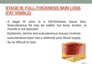 DECUBETIC ULCER (Bed Sores).pptx | Skin and Dermatology | Diseases and ...