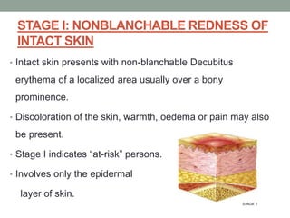 DECUBETIC ULCER (Bed Sores).pptx | Skin and Dermatology | Diseases and ...