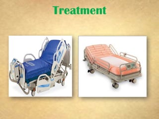 decubital ulcer magement and treatment.pptx