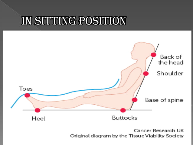 DECUBITUS ULCER.pdf | Skin and Dermatology | Diseases and Conditions