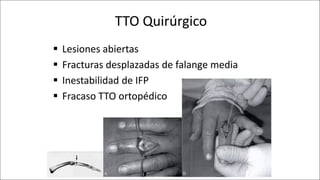Dedo con deformidad en ojal o “boutonnière” | PDF