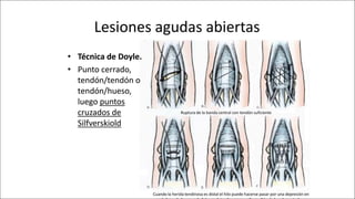 Dedo con deformidad en ojal o “boutonnière” | PDF