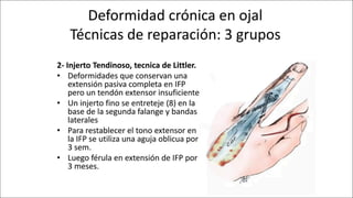 Dedo con deformidad en ojal o “boutonnière” | PDF