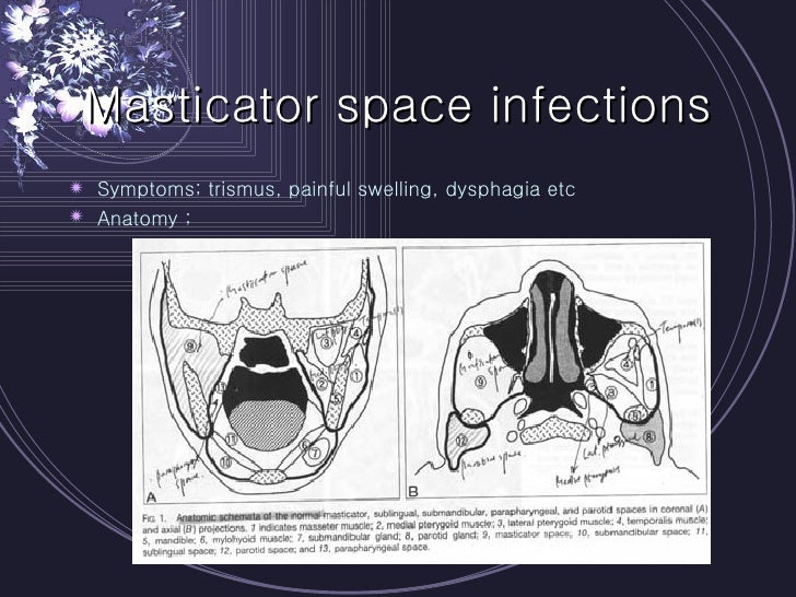 Deep Neck Infections