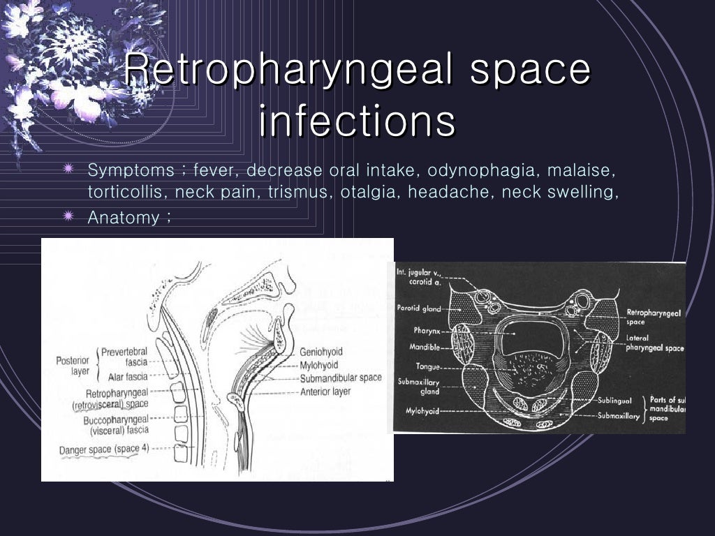 Deep Neck Infections